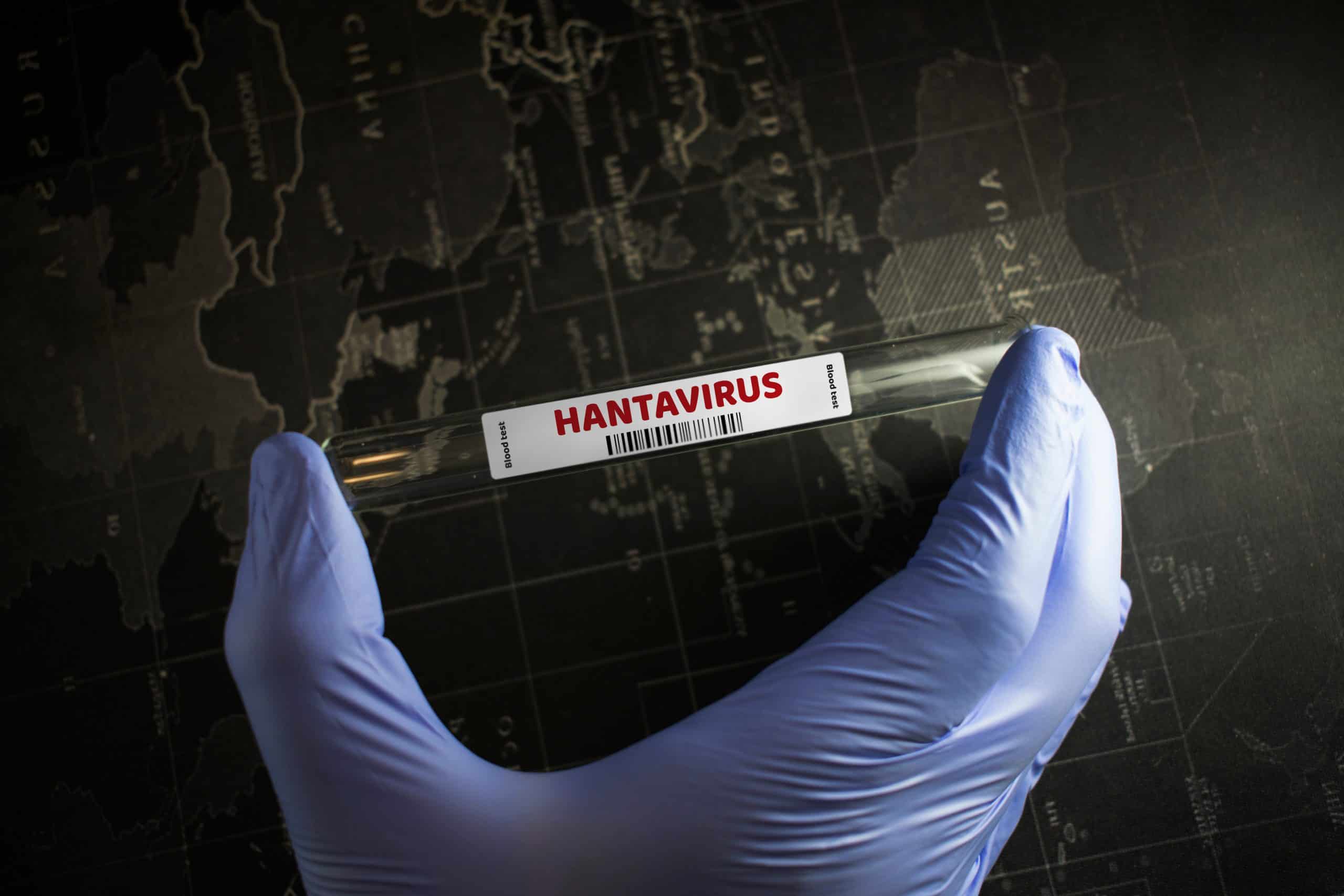 Mišja groznica - kako se liječi i koji su simptomi - Arz.hr