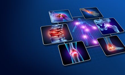 Slezena - stalni bolovi i simptomi da nešto nije u redu - Arz.hr