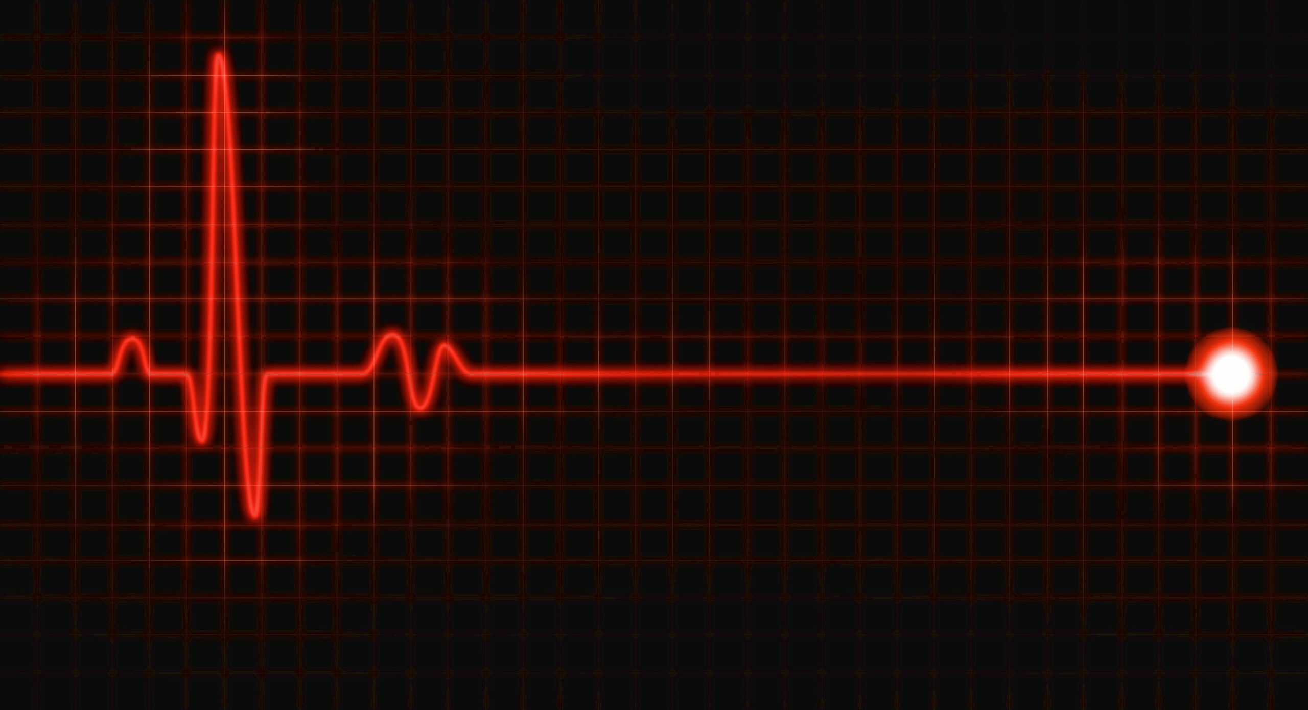 Normalni otkucaji srca - Arz.hr