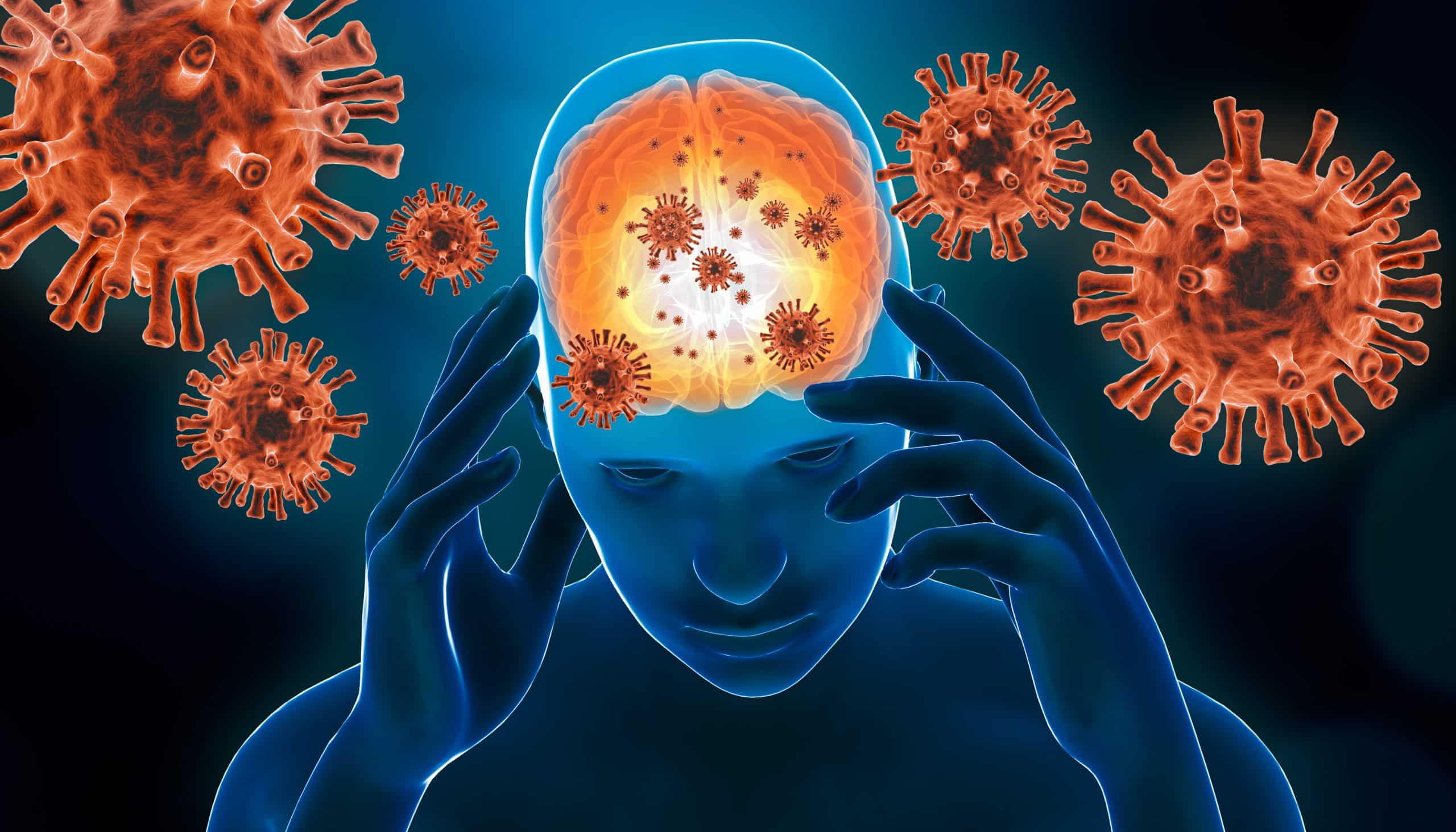 Virusni meningitis - uzrok, simptomi, liječenje - Arz.hr