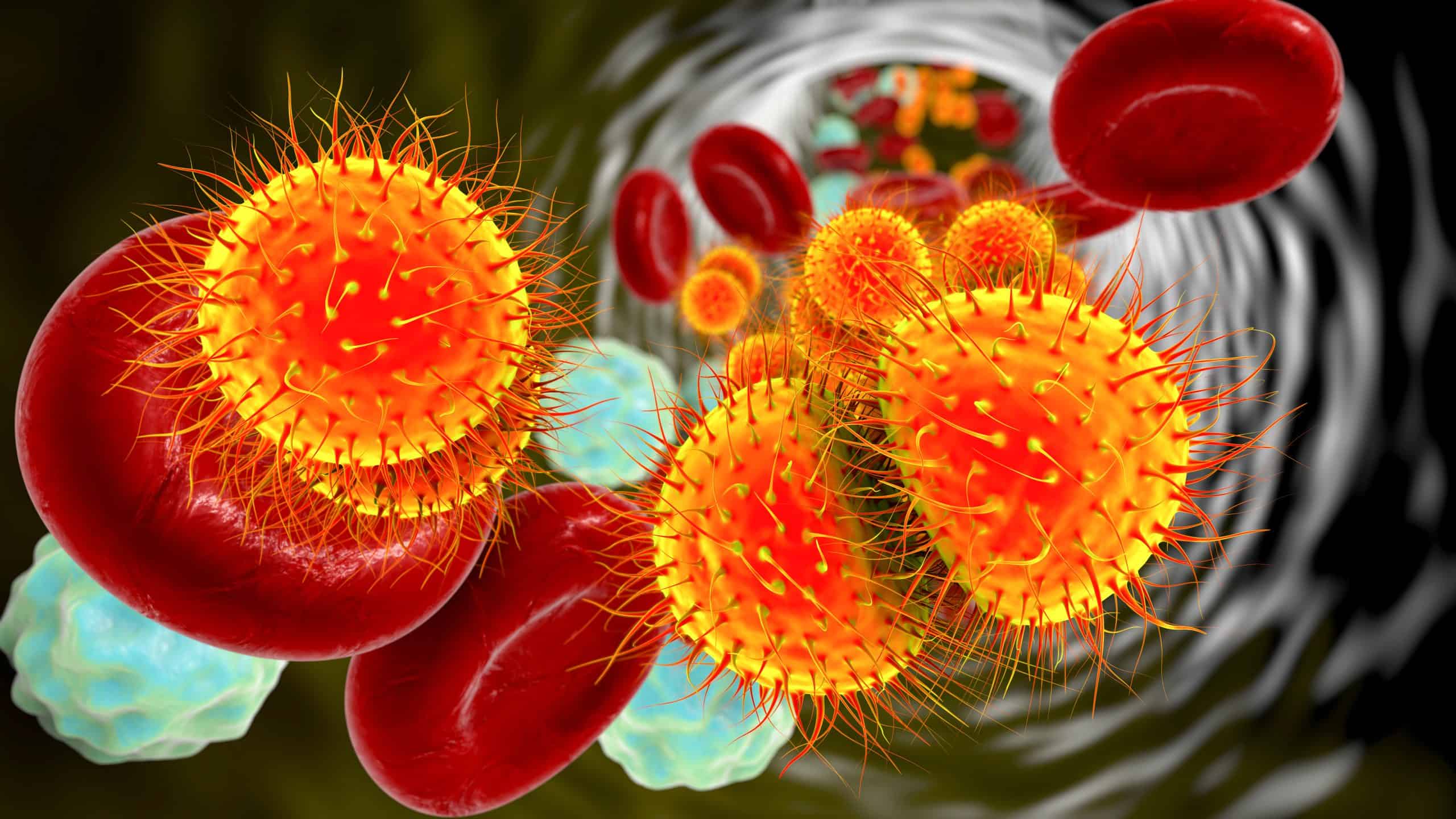 Meningokokna sepsa - uzrok, simptomi, liječenje - Arz.hr