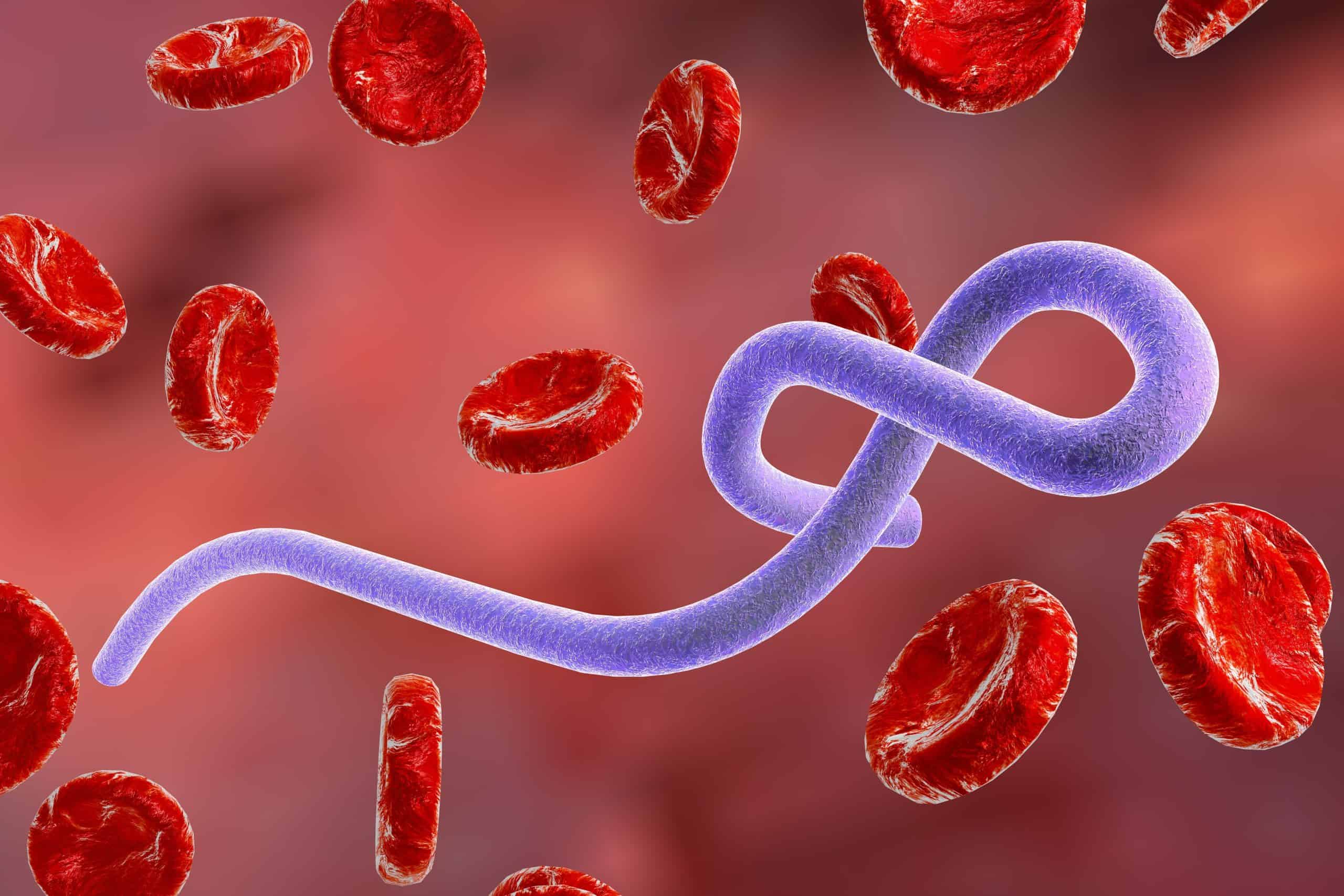 Virusne hemoragijske groznice - uzrok, simptomi i liječenje - Arz.hr