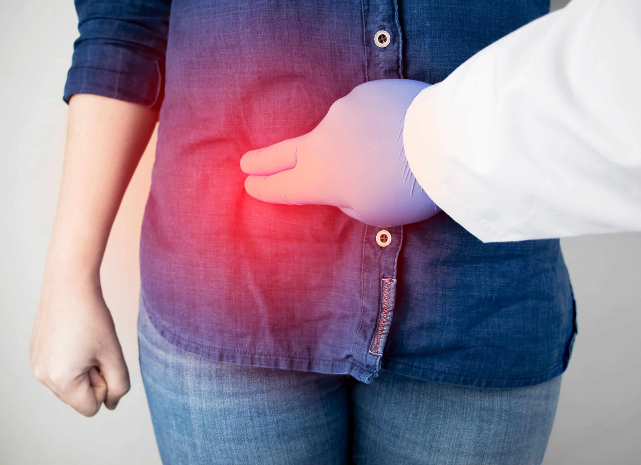 Što je apendektomija - Arz.hr