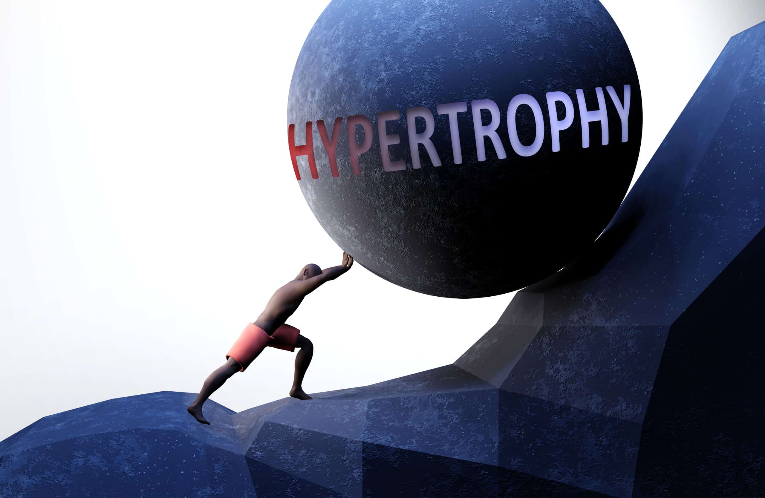 Hipertrofija - uzrok, simptomi, liječenje - Arz.hr
