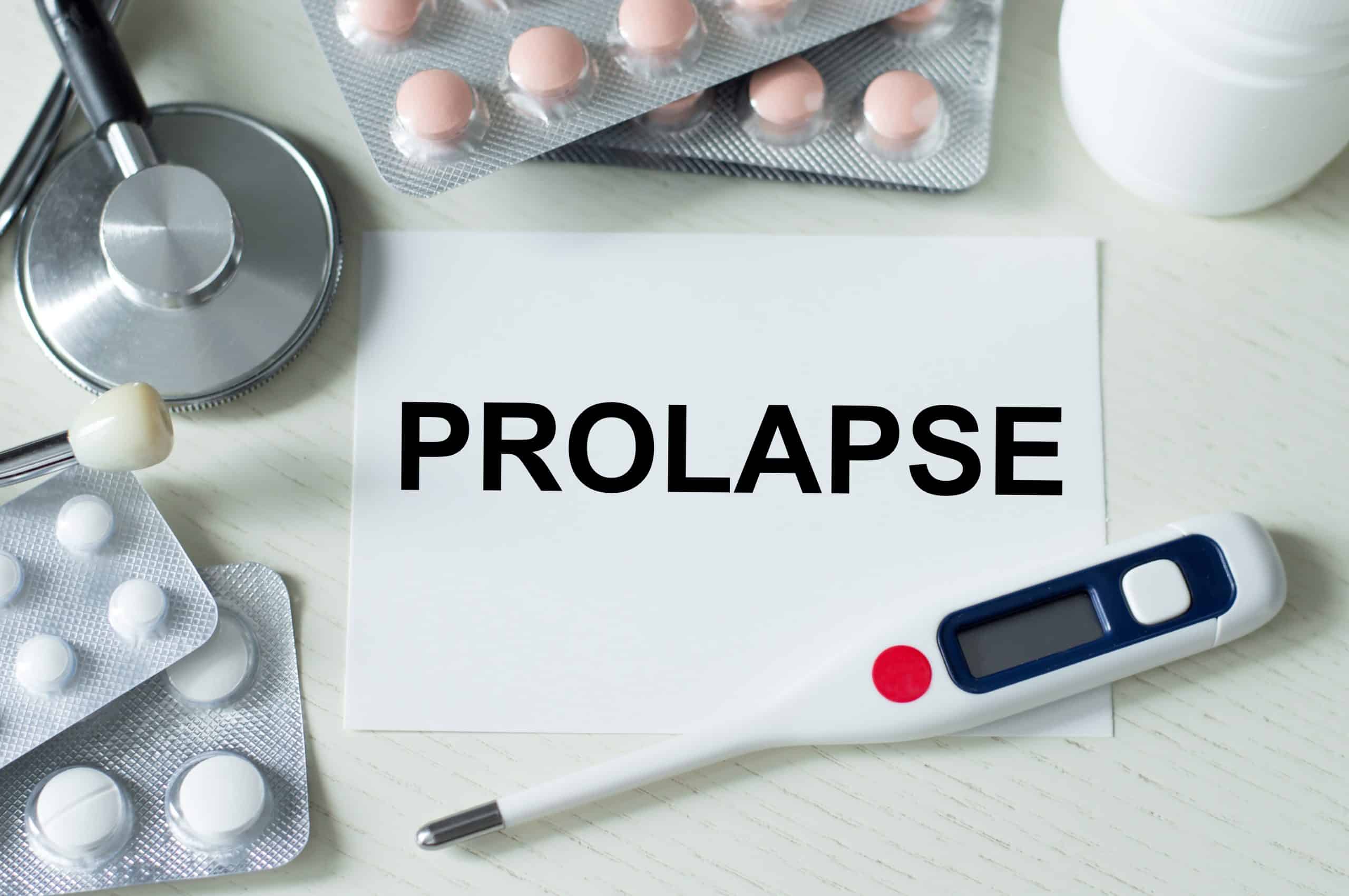 Što je prolaps - Arz.hr