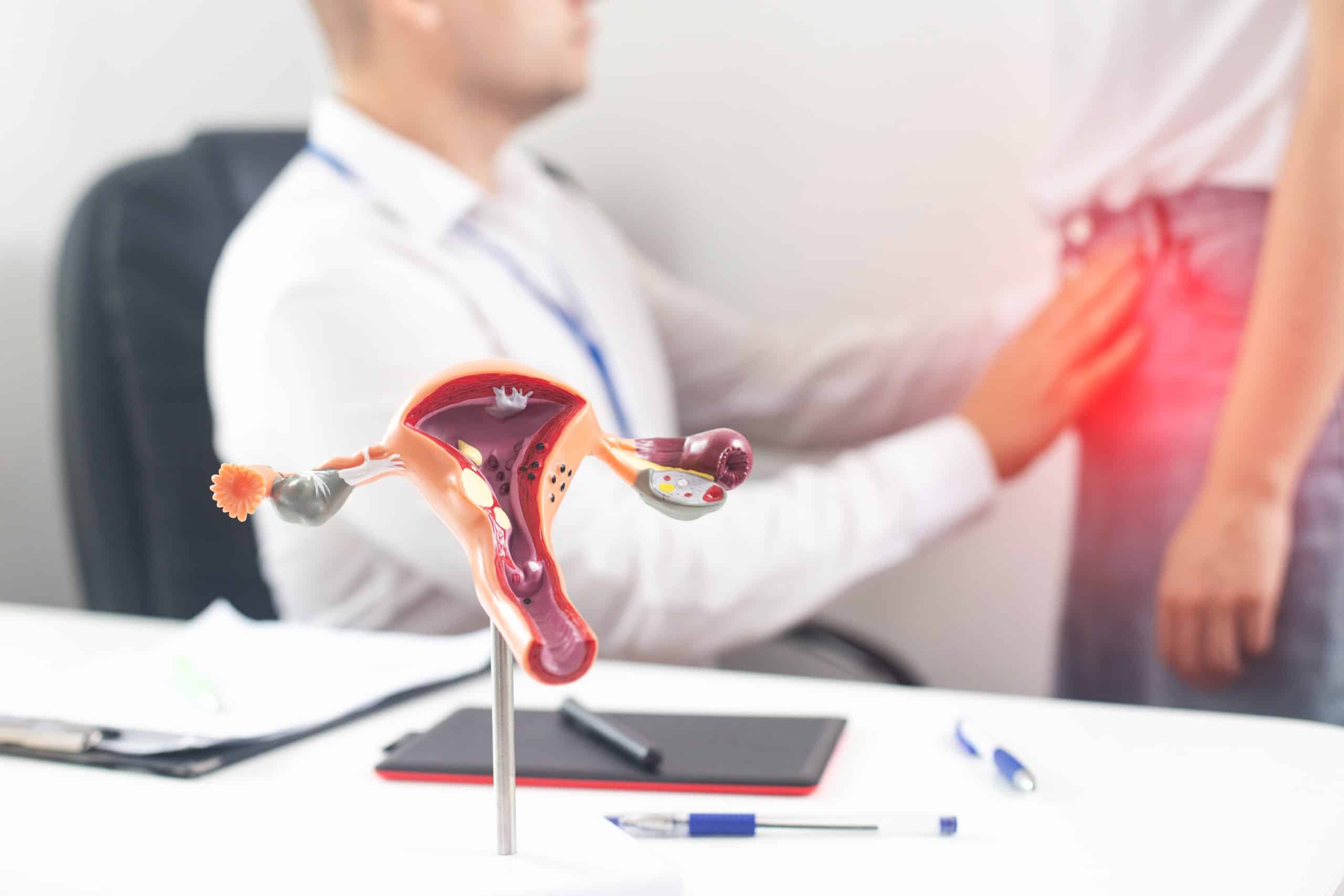Endometritis - uzrok, simptomi, liječenje - Arz.hr