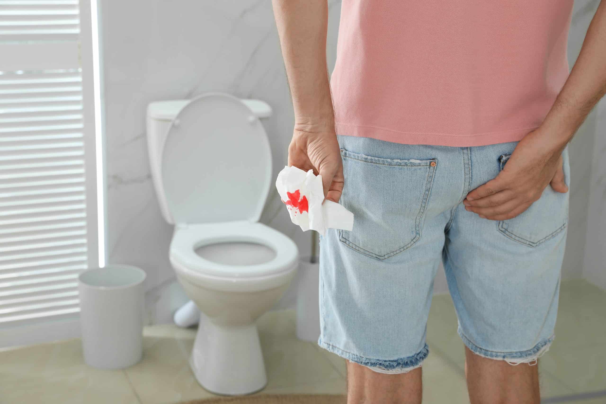 Čirevi na zadnjici - Arz.hr