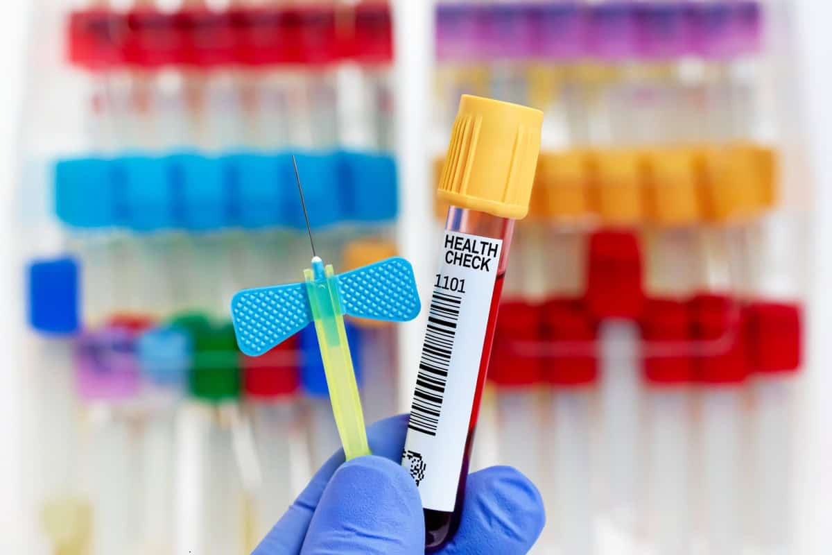 Gdje se rade markeri na hepatitis - Arz.hr